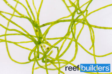 Chaetomorpha Strains are Much More Different Than We Ever Knew | Reef ...